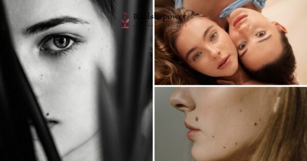 The Fascinating World Of Face Moles: What Do Those Little Dots Mean?